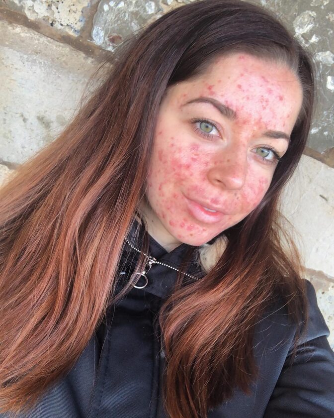 Emily Keel - galeria zdjęć