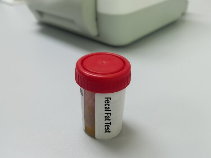 Celiakia – co to jest, objawy, przyczyny, diagnostyka, dieta i ...