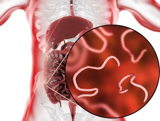 Świerzb – przyczyny, objawy, rodzaje i leczenie – Zdrowie Wprost