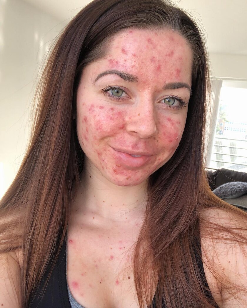 Emily Keel - galeria zdjęć