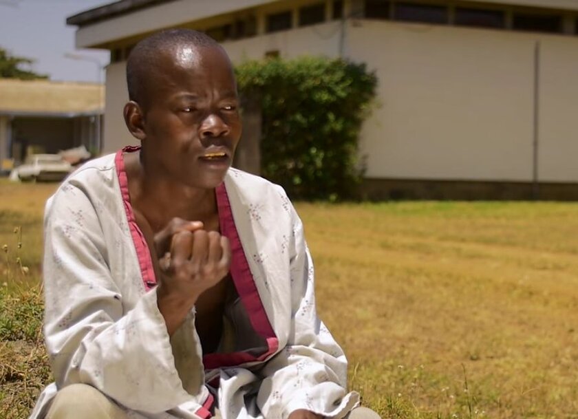 Horace Owiti Opiyo przed zabiegiem - galeria zdjęć
