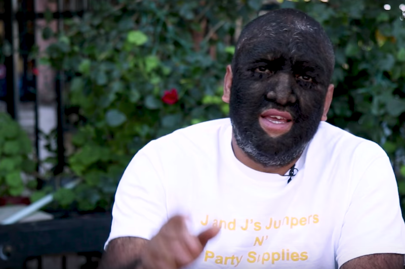 USA: Oto „Człowiek Wilk” Larry Gomez z Kalifornii – Wprost