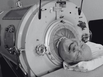 Nie żyje Paul Alexander. 70 lat żył w „żelaznym płucu” – Wprost