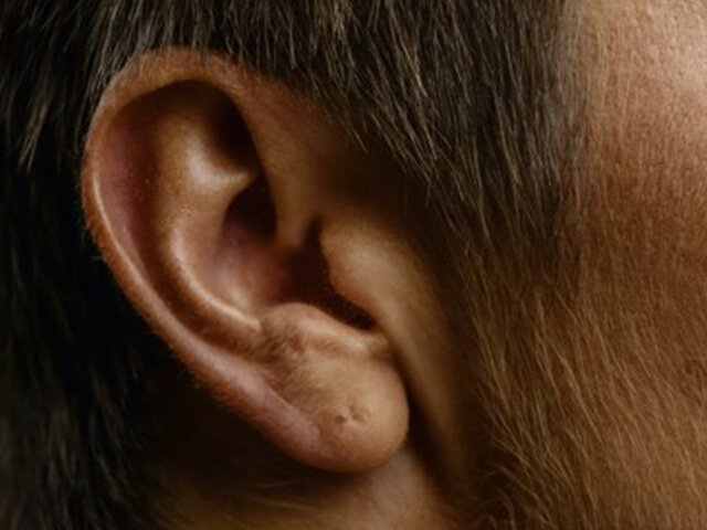 Znak Franka może być objawem choroby serca – Zdrowie Wprost