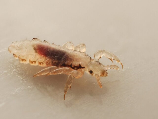 Tyfus plamisty – objawy, leczenie, powikłania – Zdrowie Wprost